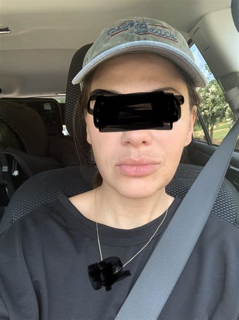 Uneven Face And Body R Orthotropics