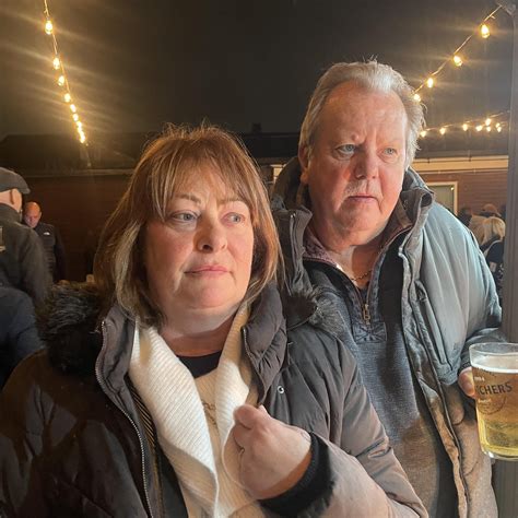 Simplicity Beauty Academy Dermaplaning Just £20 Dermaplaning Fast