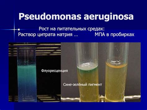 Частная микробиология. Pseudomonas aeruginosa, род proteus