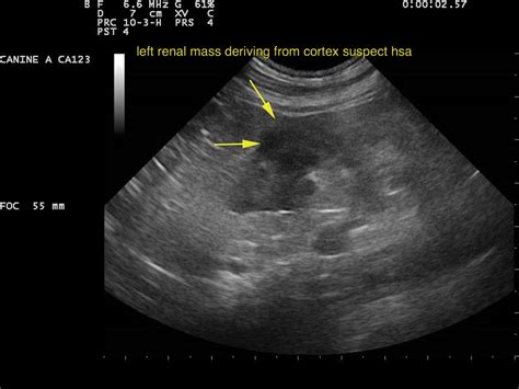 Renal Mass Likely Hemangiosarcoma In A 10 Year Old Fs Golden