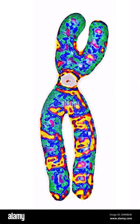 Human Chromosome 23 Pairs Of Chromosomes 46 Chromosomes 22 Pairs Are Common To Both Sexes