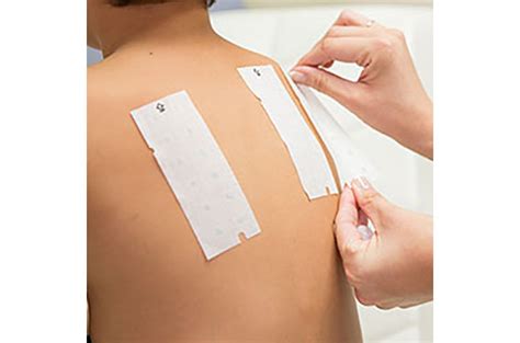 Σπιτικό τεστ ευαισθησίας σε τροφές Patch Sensitivity Test The