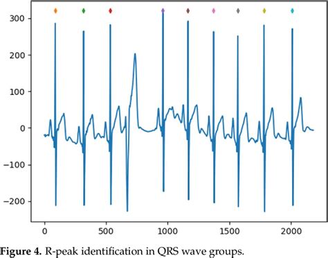 Figure 4 From Ecg Multi Emotion Recognition Based On Heart Rate