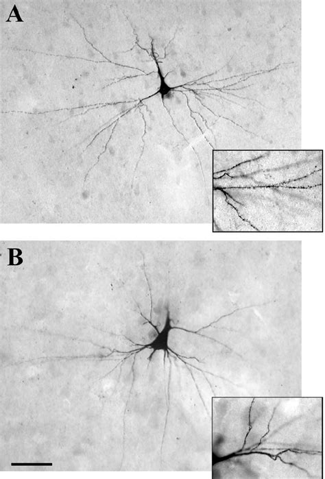 Layer Iii Pyramidal Neurons Filled Intracellularly With Ly And Reacted