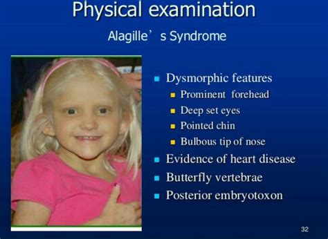 Alagilles Syndrome 02 【 Effect Heart And Lungs 】 【 Associated With