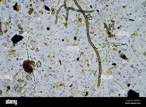 Fungal And Fungi Hyphae Under The Microscope In The Soil And Compost