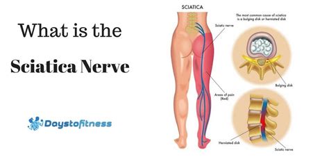 What Is The Sciatic Nerve Days To Fitness
