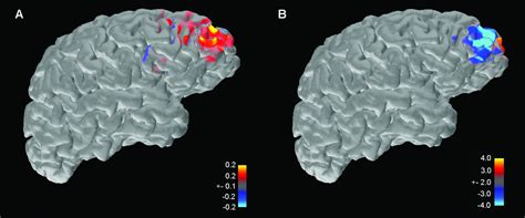 A Multimodal Imaging And Stimulation Based Method Of Evaluating Connectivity Related Brain
