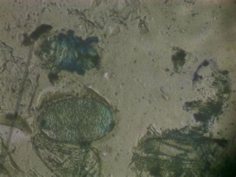 Psoroptes Cuniculi And Egg