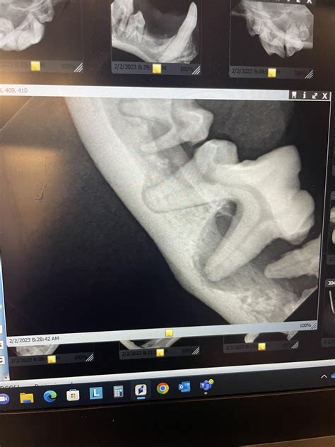 Took My First Dental Radiographs R Vettech