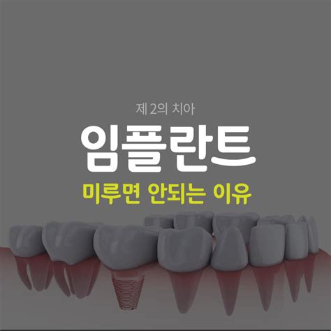 이튼연합치과 손상되거나 상실된 치아를 치료하는 방법 임플란트 🦷 임플란트를 고민하고 있으시다면