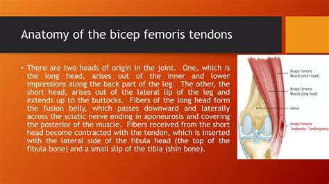 Bicep Femoris Tendinitis Pdf