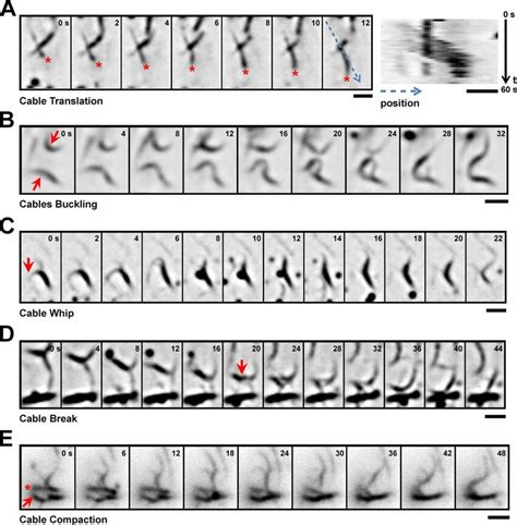 Examples Of Cable Dynamics A Translation Of A Single Actin Cable