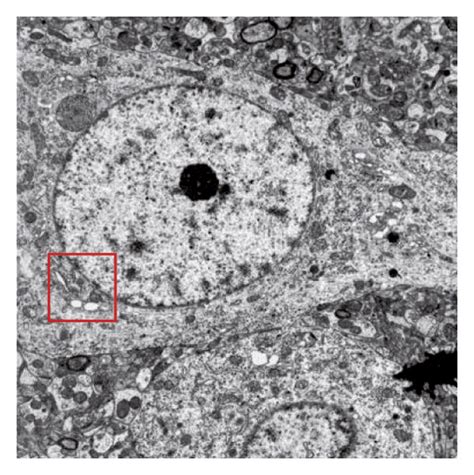 Numbers Of Neurons And Morphological Observations Of The Endoplasmic
