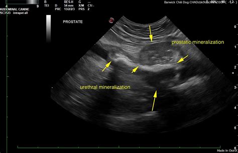 Urethral And Prostatic Mass With Iliac Lymph Node Involvement In A 9
