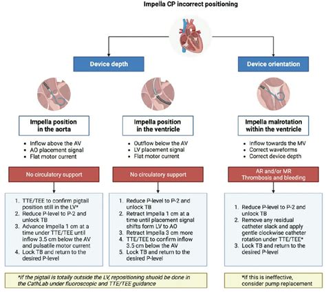 Technical Tips For Inserting And Positioning The Impella Device