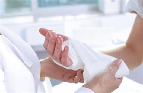 Broken Hand Recovery Hand Fracture Splint Treatment And Healing Time