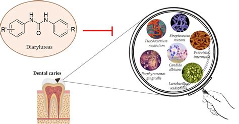Streptococcus Mutans