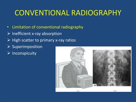 Ct Generation Generation Of Ct Pptx Medical Tests Medical Health