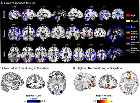 Brain Responses Associated With Cue Based Expectancy Effects A Brain