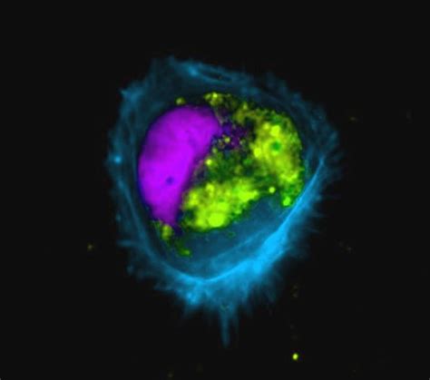 Diamond4bio On Linkedin Fluorescencemicroscopy Cancerresearch Nanodiamonds Cellculture…