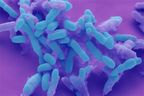 Enterobacteriaceae Hygiena