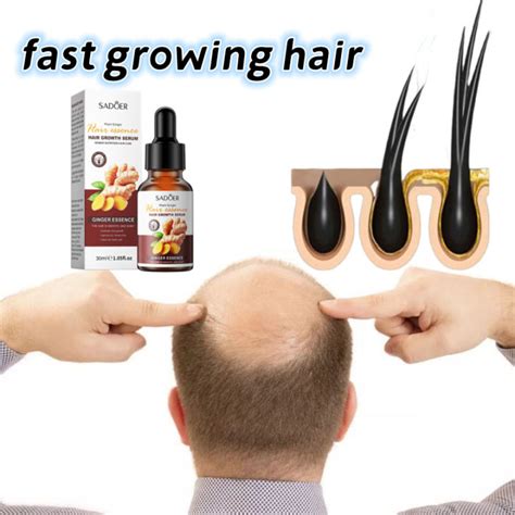 Serum Hair Growth Essential Oil 20ml Original Obat Hair Tonic Penumbuh Rambut Rontok Dan Botak