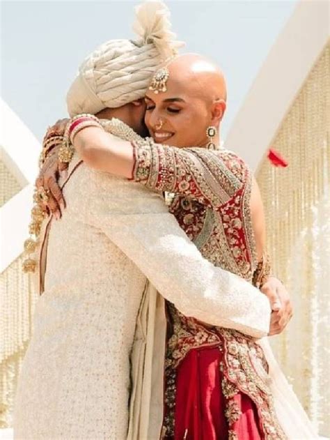 नवरीला टक्कल असं लग्न करण्यासाठी लागतं धाडस याला म्हणतात खरं प्रेम