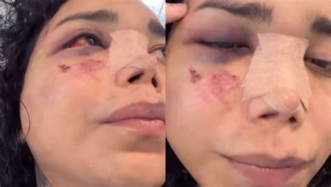 Paolita Suárez Muestra Su Avance En El Hospital Tras Ser Golpeada Por