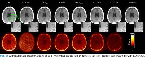 Figure 6 From Unsupervised Mri Reconstruction Via Zero Shot Learned Adversarial Transformers