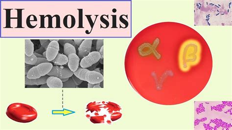 Hemolysis Youtube