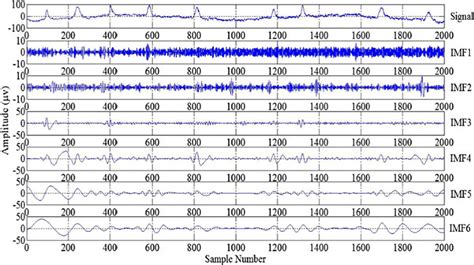 The Emd Of Right Hand Mi Task Eeg Signal Into Imfs [92] Download