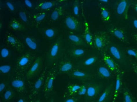 2d Automated Analysis Image Pro Media Cybernetics