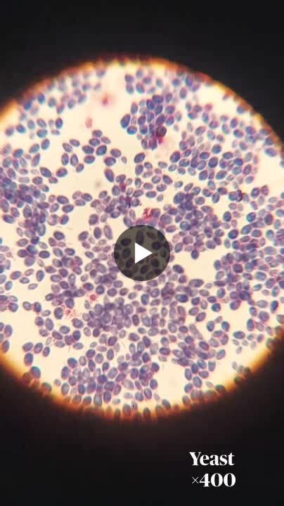 Microbiology Yeast Microscopy Biotech Learningthroughscience