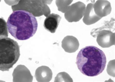 Metamyelocyte Vs Monocyte