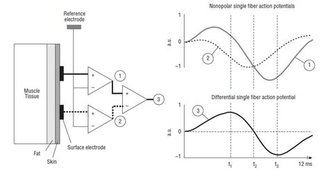 Conventional Electrode Montages Shown By A Schematic Representation Of