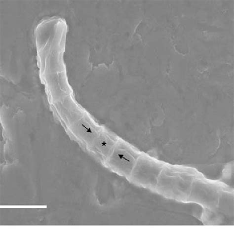 Environmental Scanning Electron Microscopy Results Intracellular Download Scientific Diagram