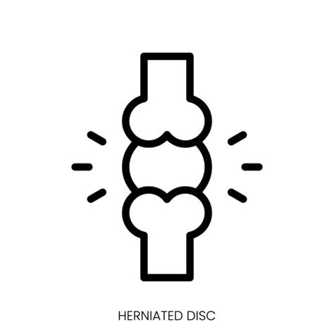 Herniated Disc Vector Images Over 300