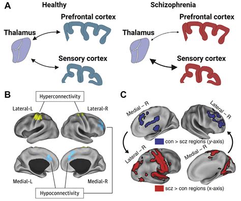 Thalamocortical Development A Neurodevelopmental Framework For Schizophrenia Pmc