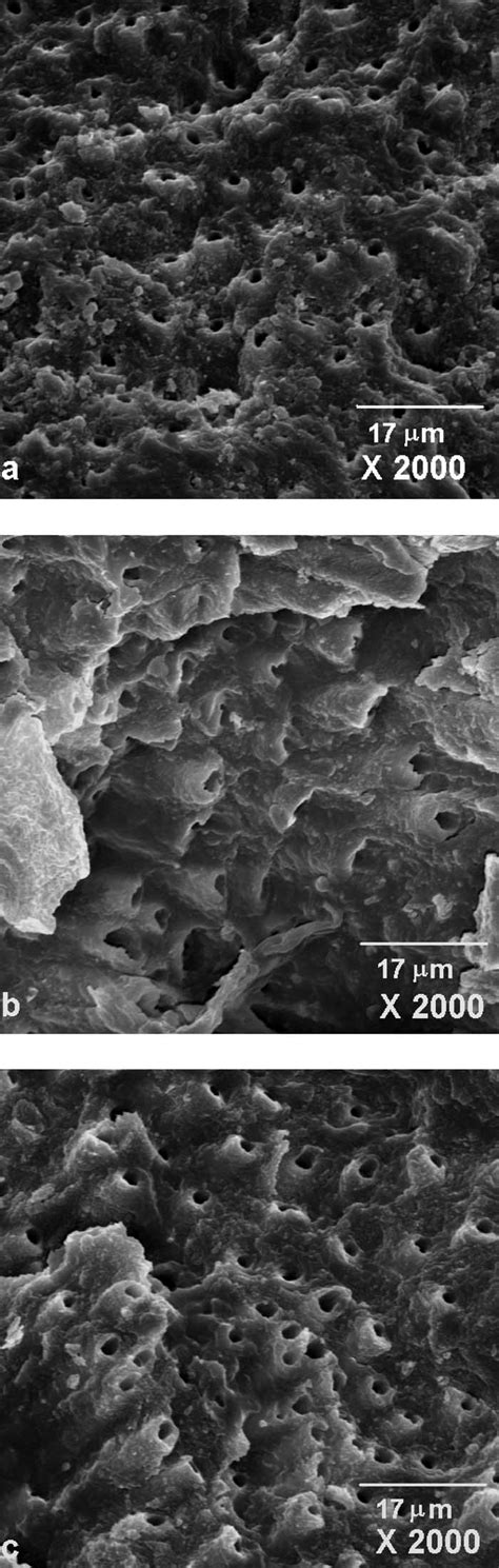 Bovine Dentin Irradiated With Eryag Laser A Normal B Demineralized Download Scientific
