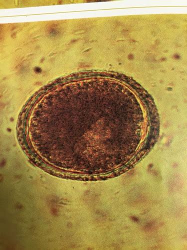 Roundworm Eggs In Dogs