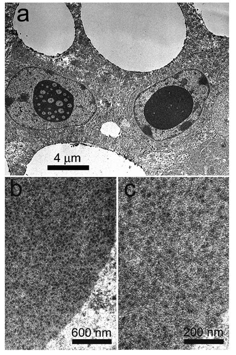 Macrobrachium Rosenbergii Transmission Electron Micrographs Of Download Scientific Diagram