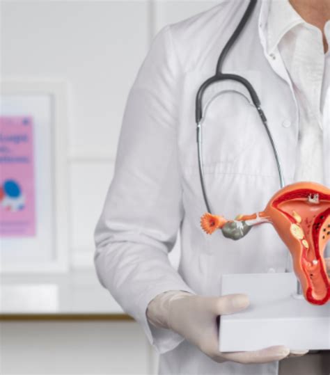 ¿cómo Prevenir Y Reducir Los Miomas