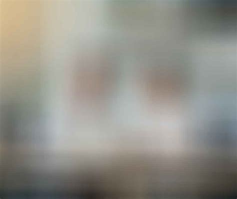 Understanding Functional Vision Loss And Supportive Care Specialty Vision