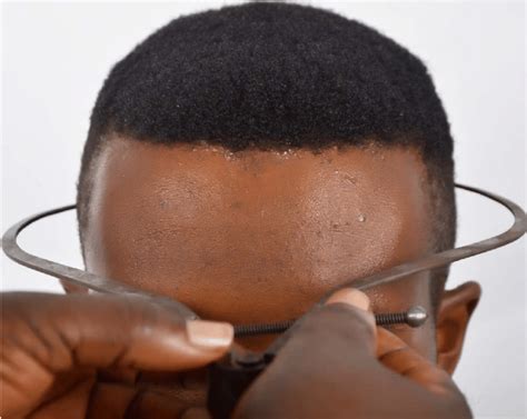 Measurement Of Head Width Download Scientific Diagram