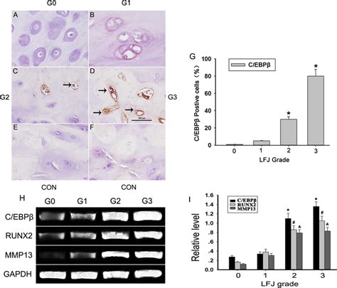 expression levels of c ebpβ and runx2 were upregulated in human lfj