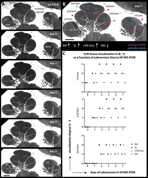 Hf Wd Pom Related Soft Tissue Visualization In Ie1l A Visualization