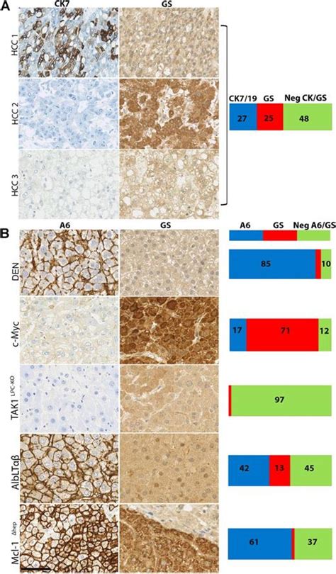 Characterization Of Hcc Mouse Models Towards An Etiology Oriented Subtyping Approach