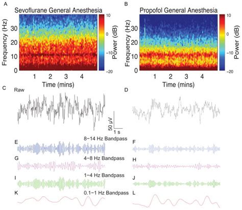 Effects Of Sevoflurane And Propofol On Frontal Electroencephalogram Power And Coherence Pmc