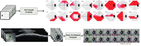 Visual Field Vf And Optical Coherence Tomography Oct Image